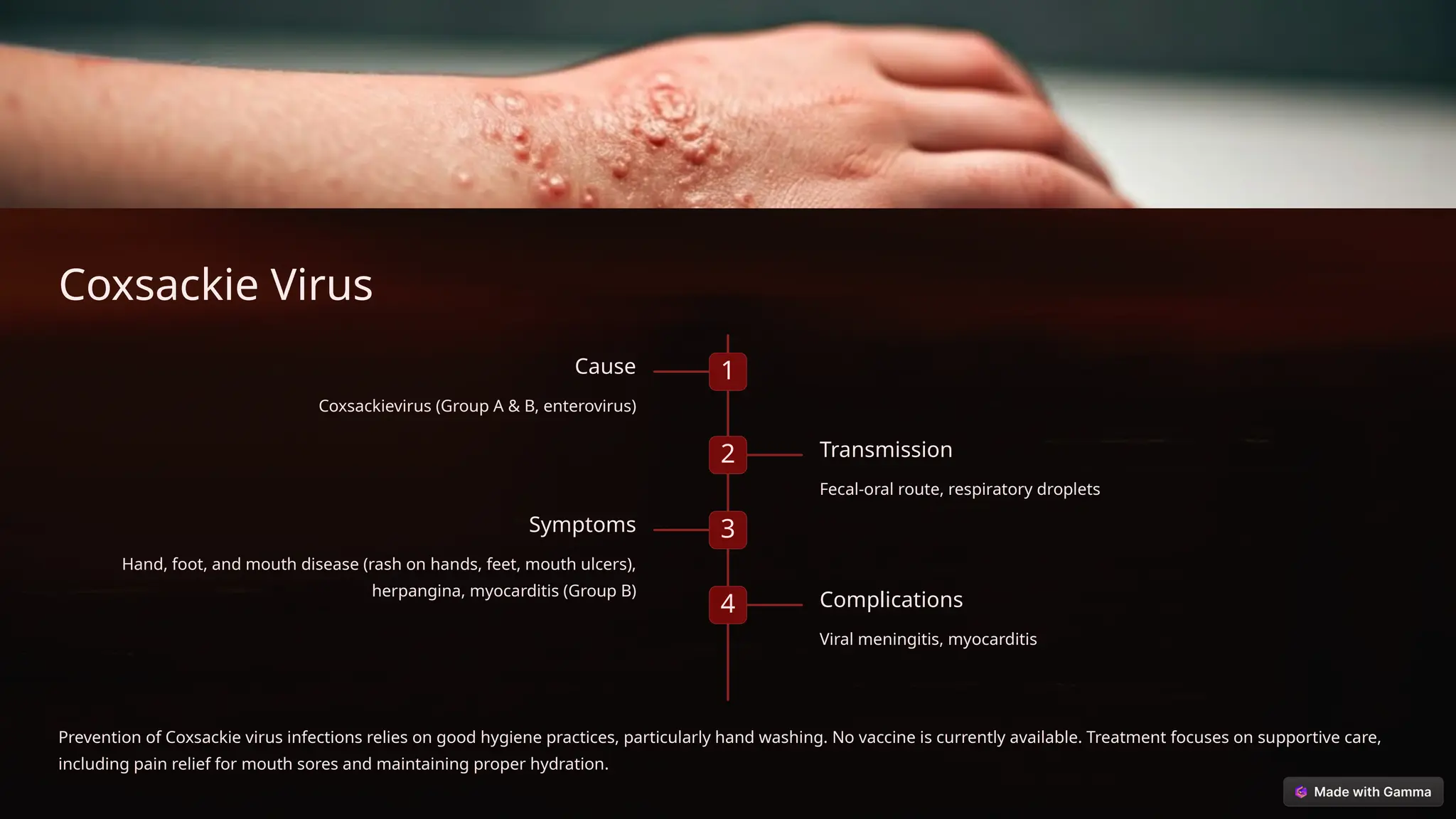 Viral-Infections-An-Overview measles coxsackie mumps HIV.pptx