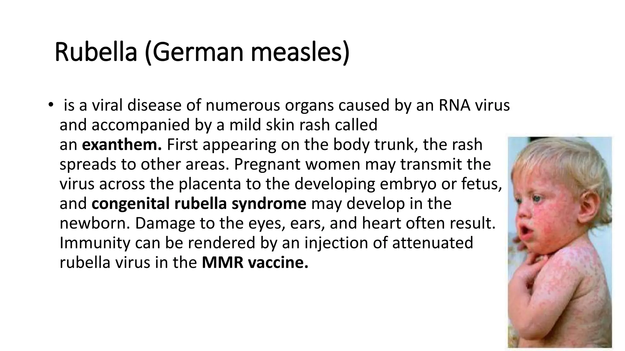 Viral skin-diseases | PPTX