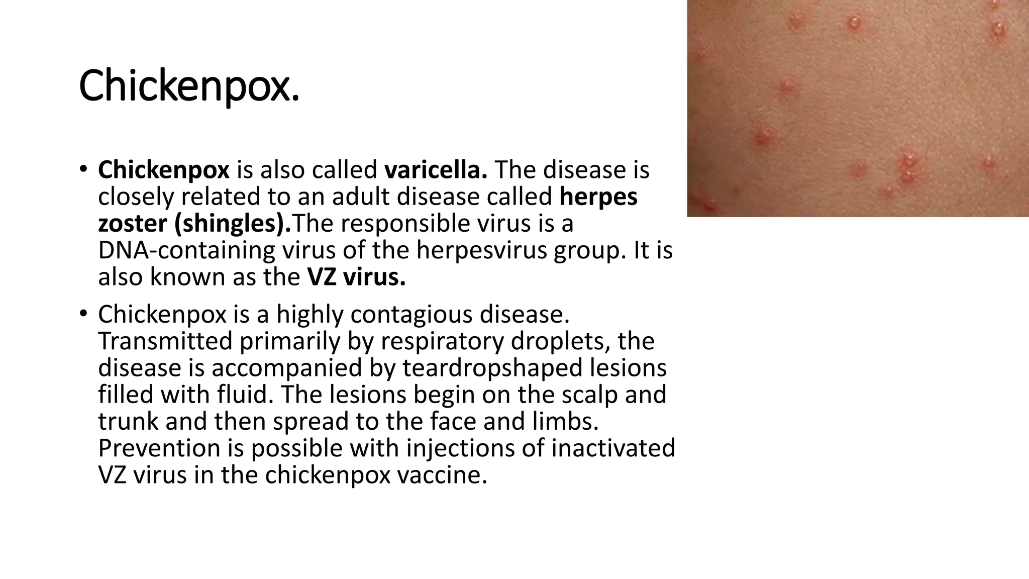 Viral skin-diseases | PPTX