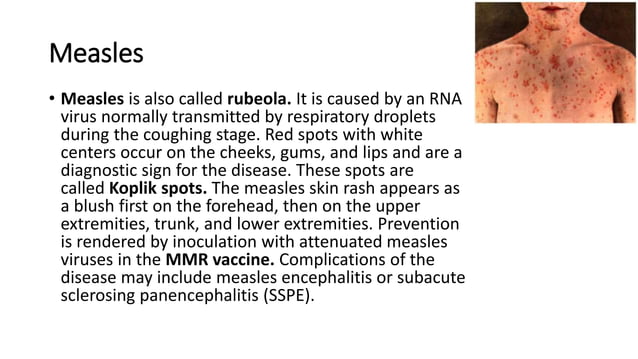 Viral skin-diseases | PPT
