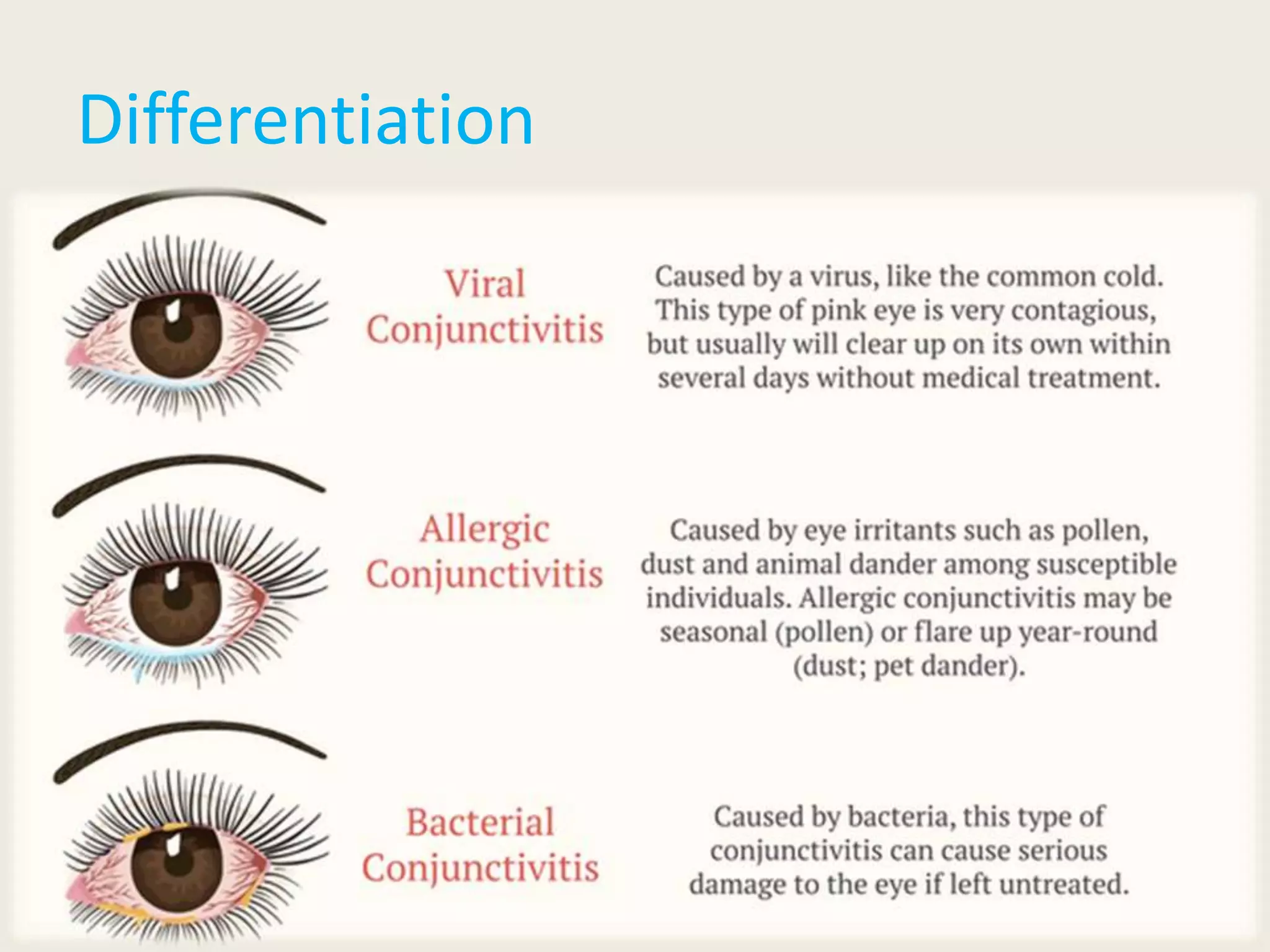 Viral conjunctivitis basic overview | PPTX