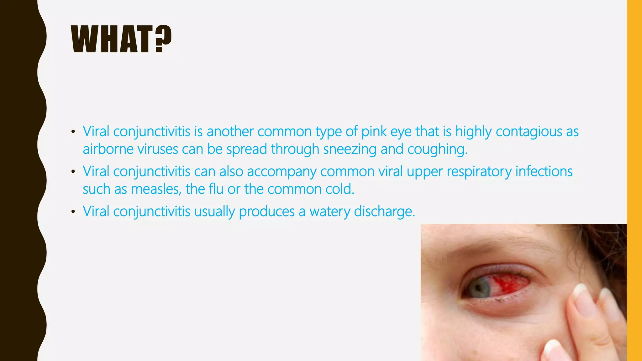 Viral conjunctivitis | PPTX