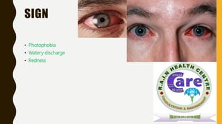 Viral conjunctivitis | PPTX