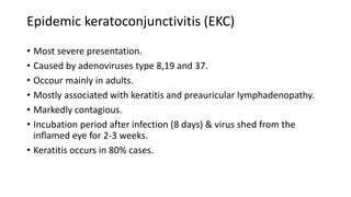 Viral conjunctivitis | PPTX