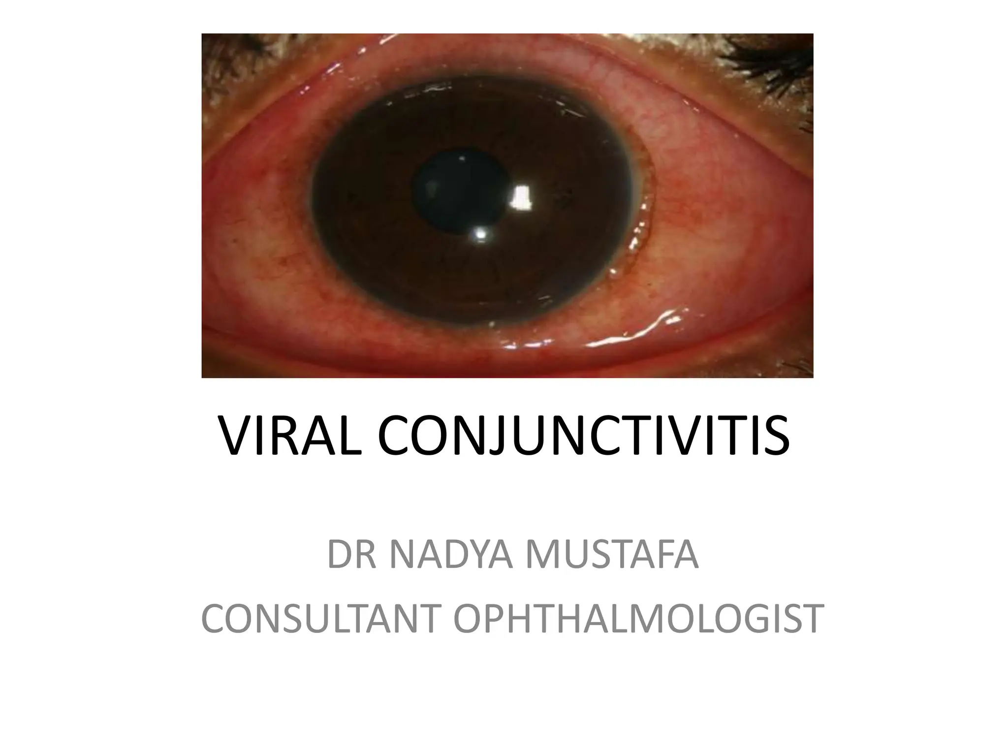 VIRAL CONJUNCTIVITIS Lecture-EKC (1).pptx