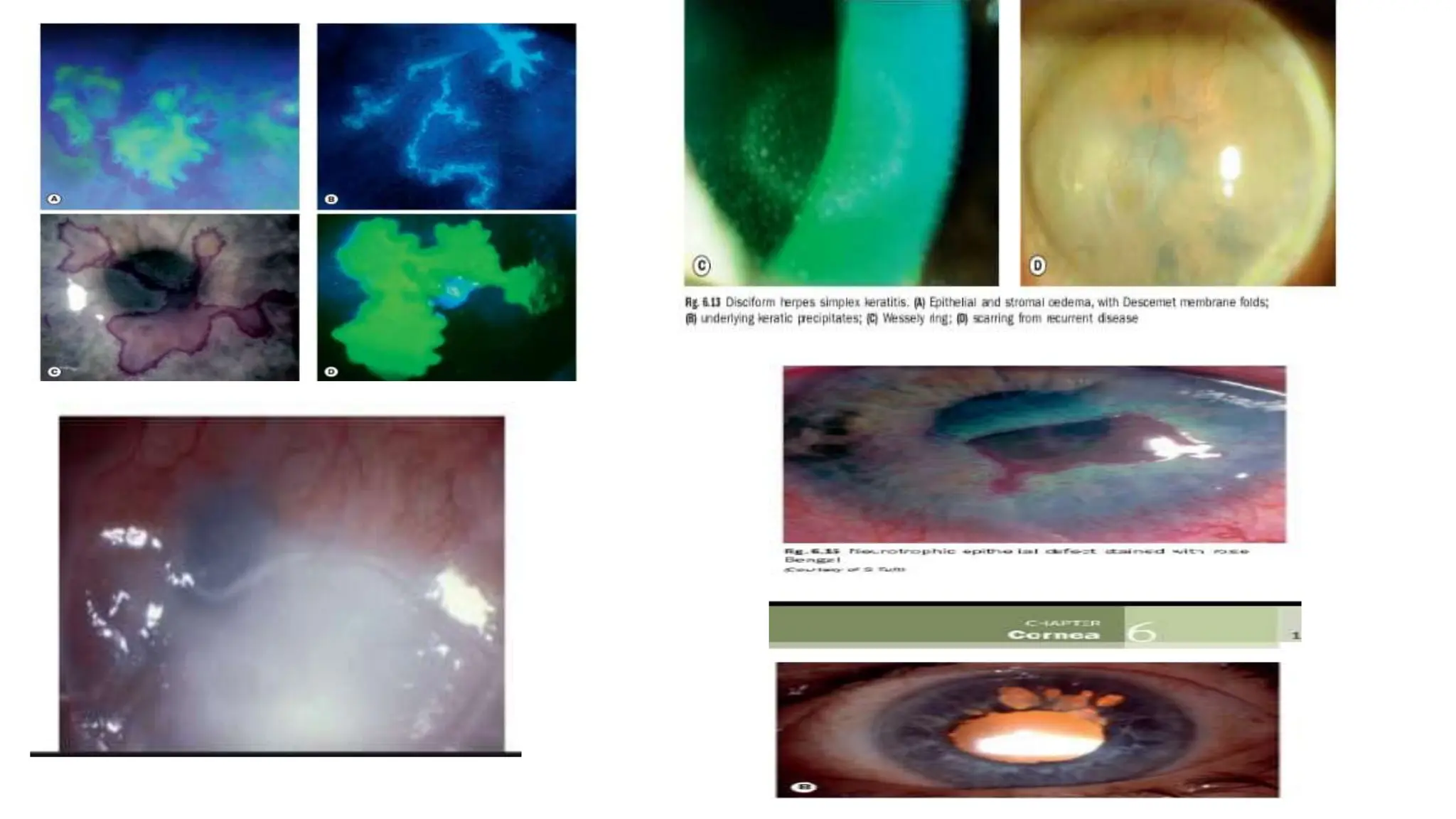 VIRAL CORNEAL UCLERS.pptx introduction etiology risk factors clinical features diagnosis ...