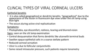 VIRAL CORNEAL UCLERS.pptx introduction etiology risk factors clinical ...