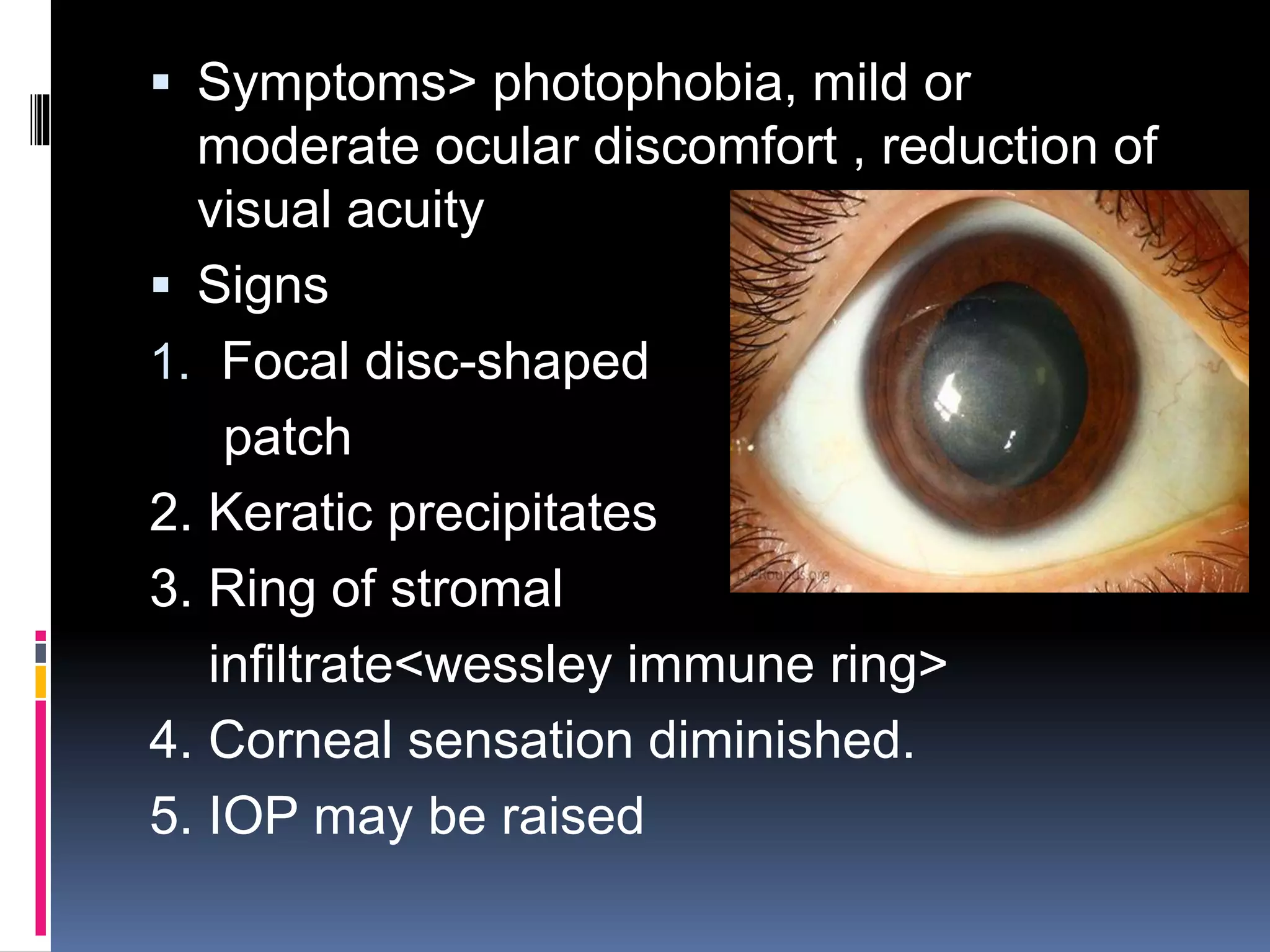 Viral corneal ulcer | PPTX