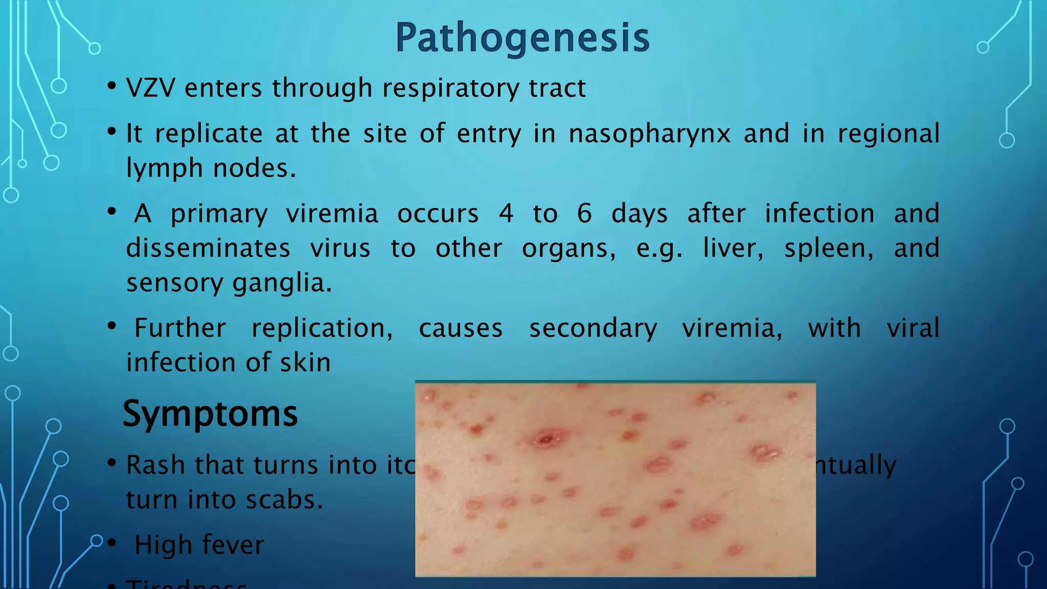 Viral disease of Human | PPTX