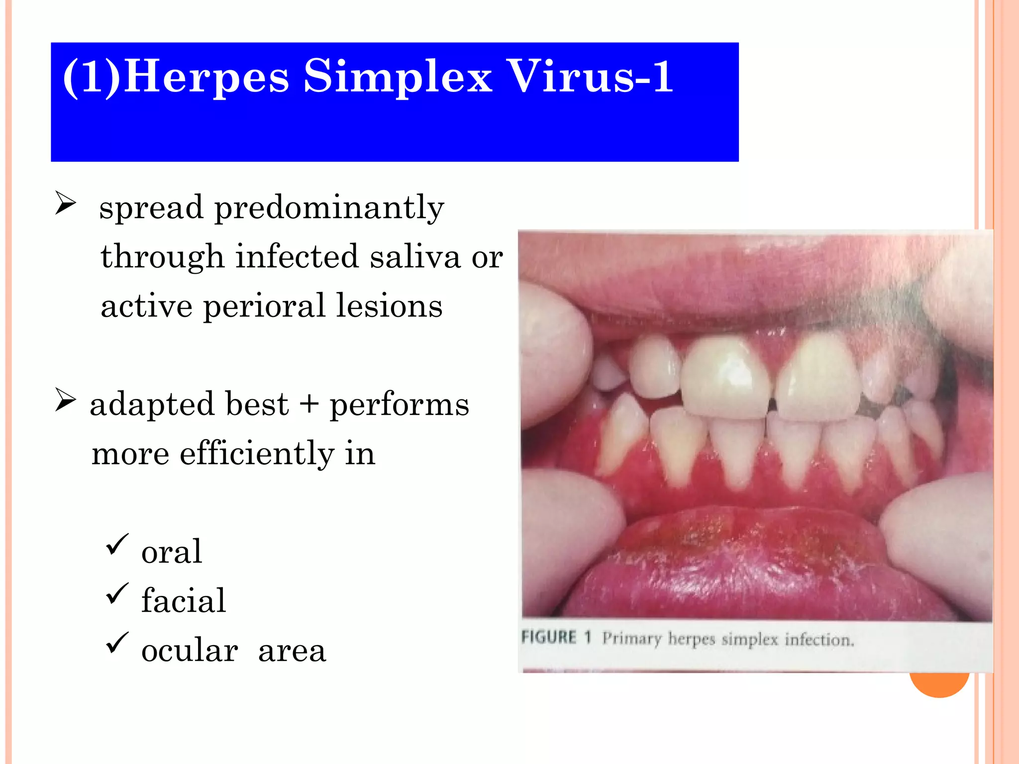Viral diseases (3) | PPT