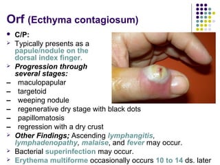 Ecthyma Contagiosum