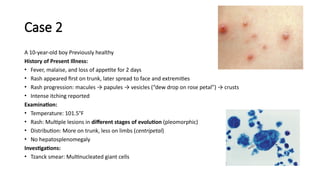 Viral exanthems / Maculopapular and Vesicular disorders.pptx