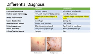 Viral exanthems / Maculopapular and Vesicular disorders.pptx