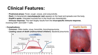 Viral exanthems / Maculopapular and Vesicular disorders.pptx