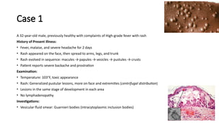 Viral exanthems / Maculopapular and Vesicular disorders.pptx