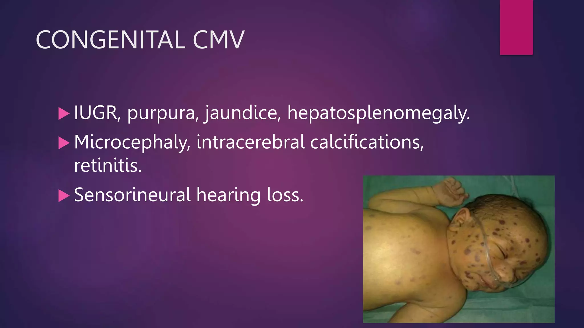 VIRAL, FUNGAL AND PARASITIC INFECTIONS.pptx | Infectious Diseases ...
