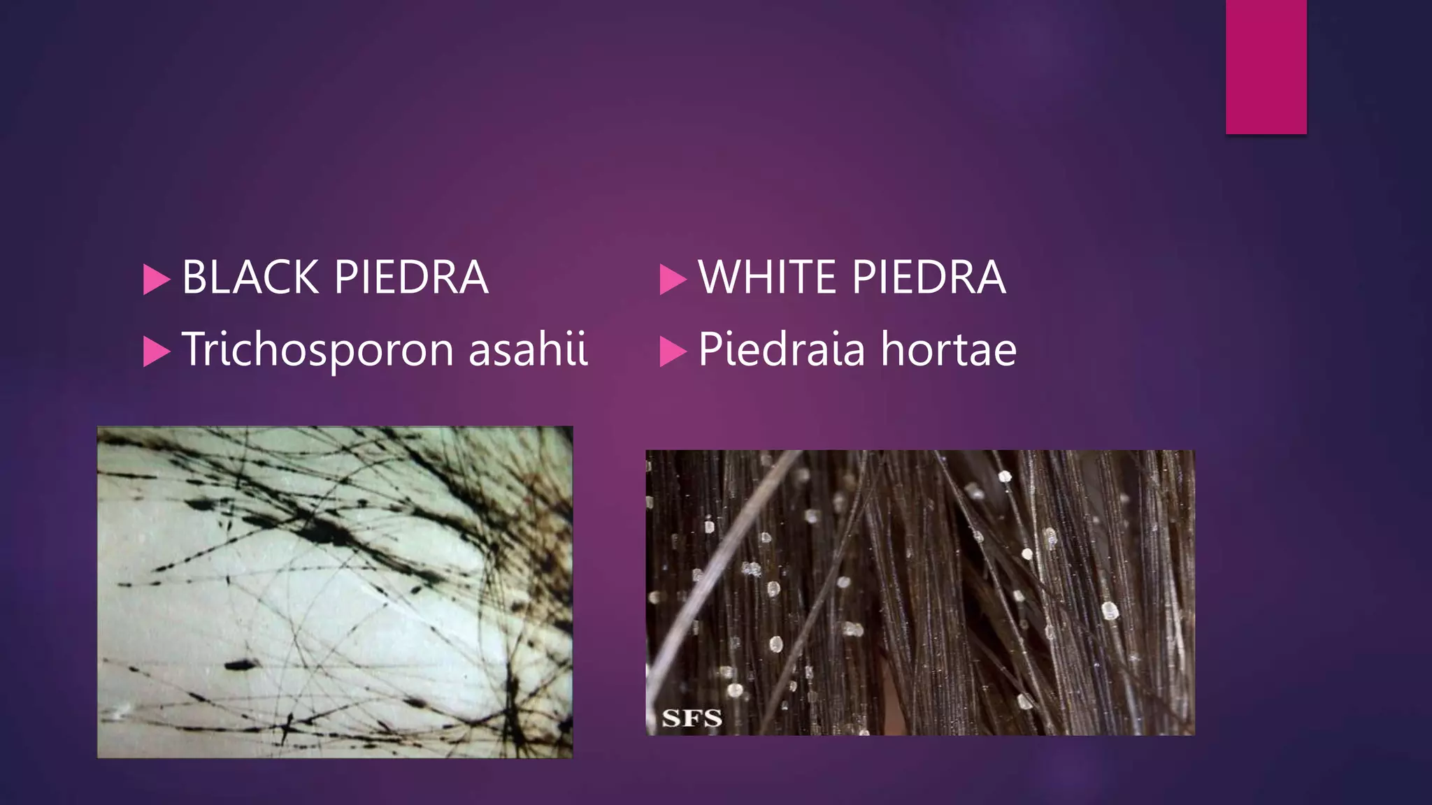 VIRAL, FUNGAL AND PARASITIC INFECTIONS.pptx | Infectious Diseases ...