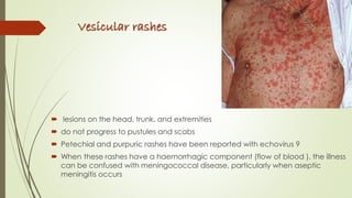 Viral gastrointestinal infections | PPTX