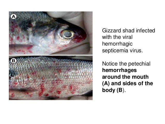 Viral heamorrhagic septicemia