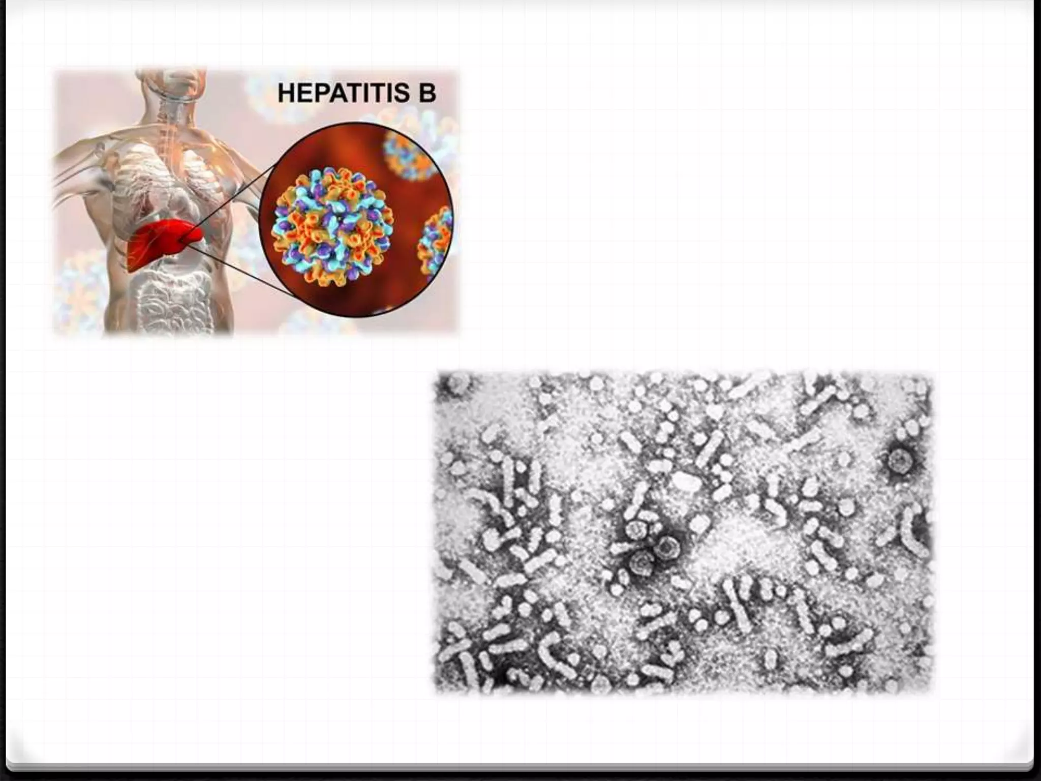 Viral Hepatitis | PPT