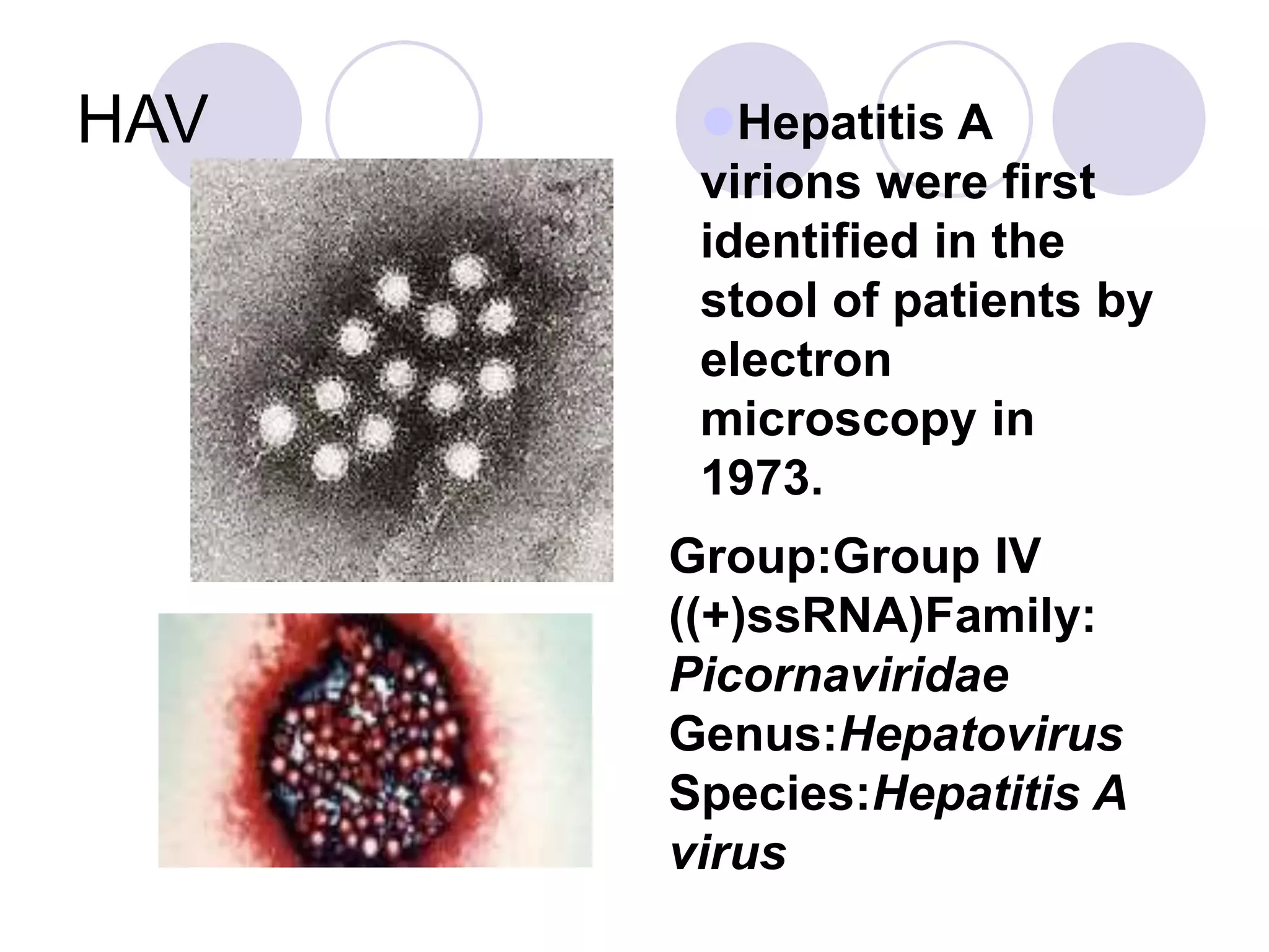 Viral hepatitis.ppt