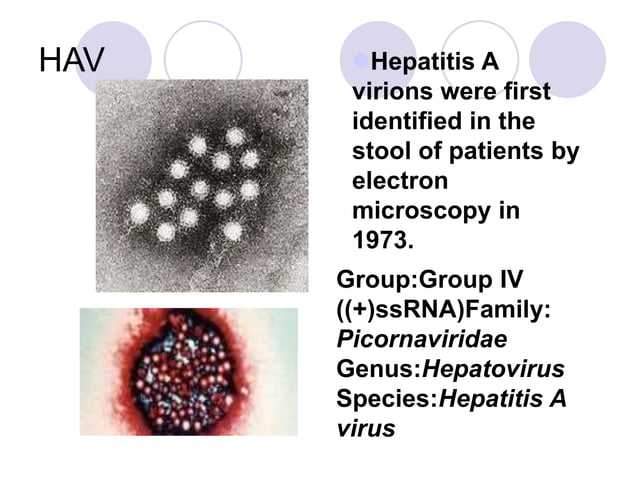 Viral hepatitis.ppt