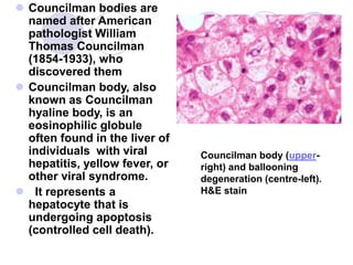 Viral hepatitis.ppt
