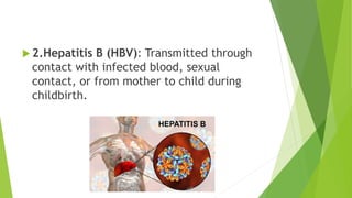 Viral hepatitis.pptx