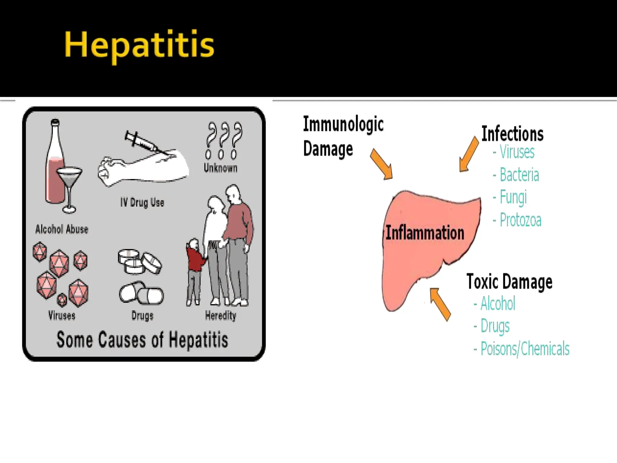 viral hepatitis in children its types .pptx