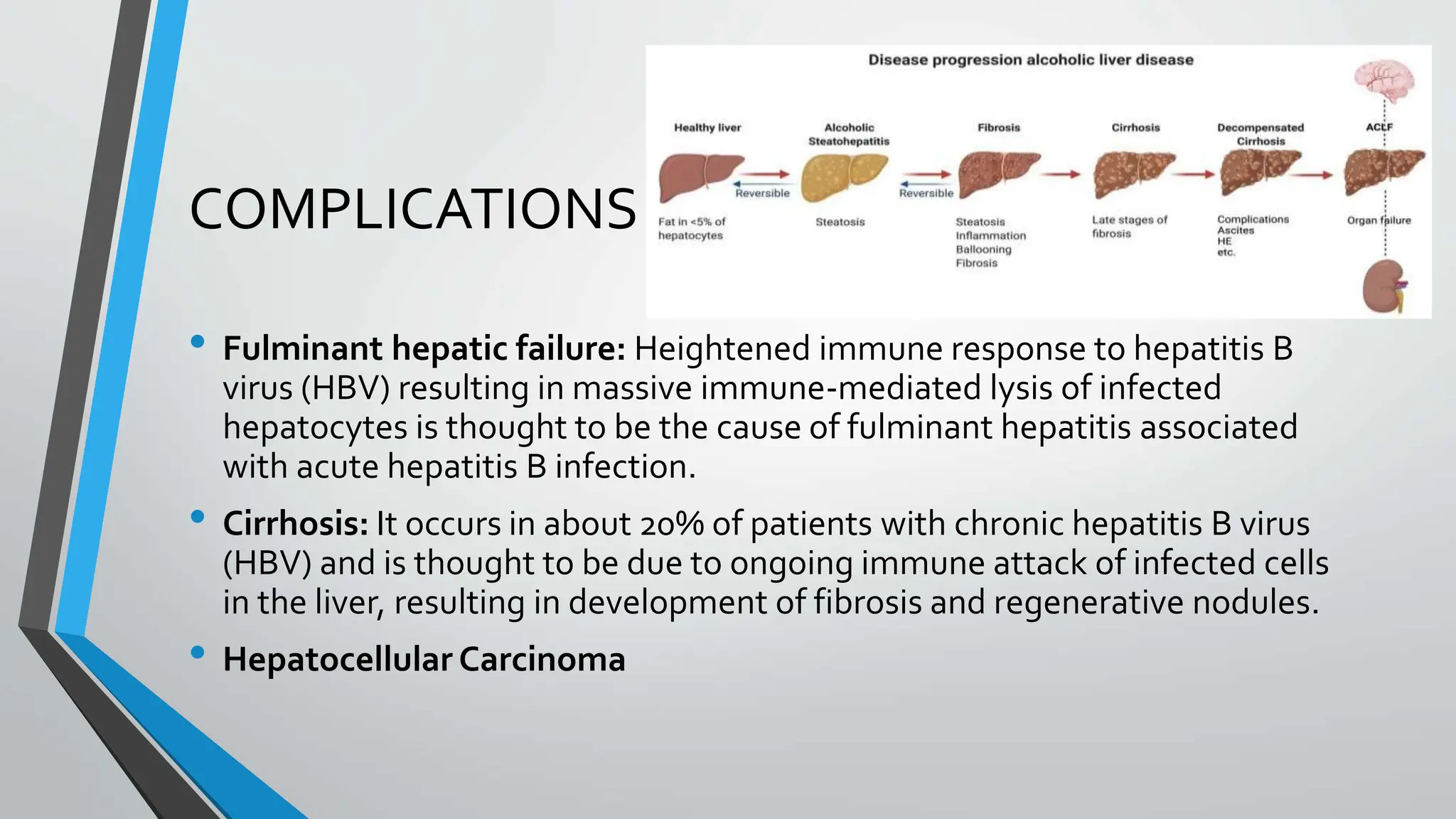 VIRAL HEPATITIS (an overview) ;presentation by Dr. Urooj Arshad. | PPT
