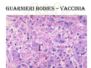 Guarnieri Bodies