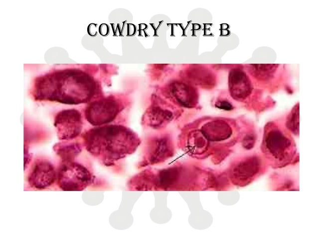 Viral host interactions