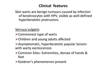 Viral infection.ppt