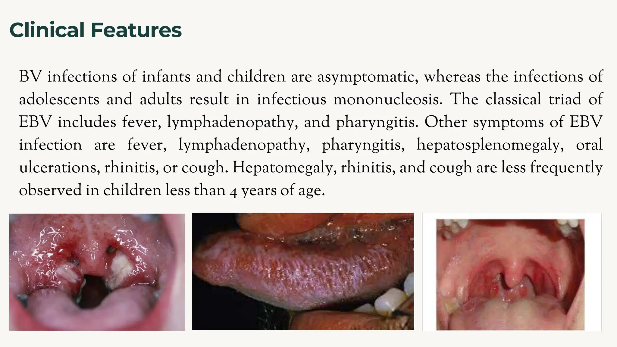 Viral infection of oral cavity .....pptx