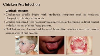 Viral infection of oral cavity .....pptx