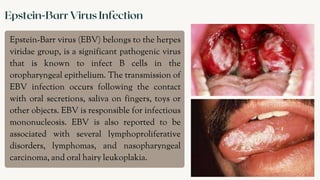 Viral infection of oral cavity .....pptx
