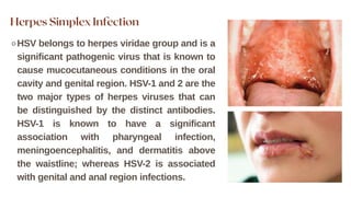 Viral infection of oral cavity .....pptx