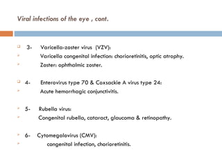 Viral infection of the eye AK updated 2019 (1).ppt