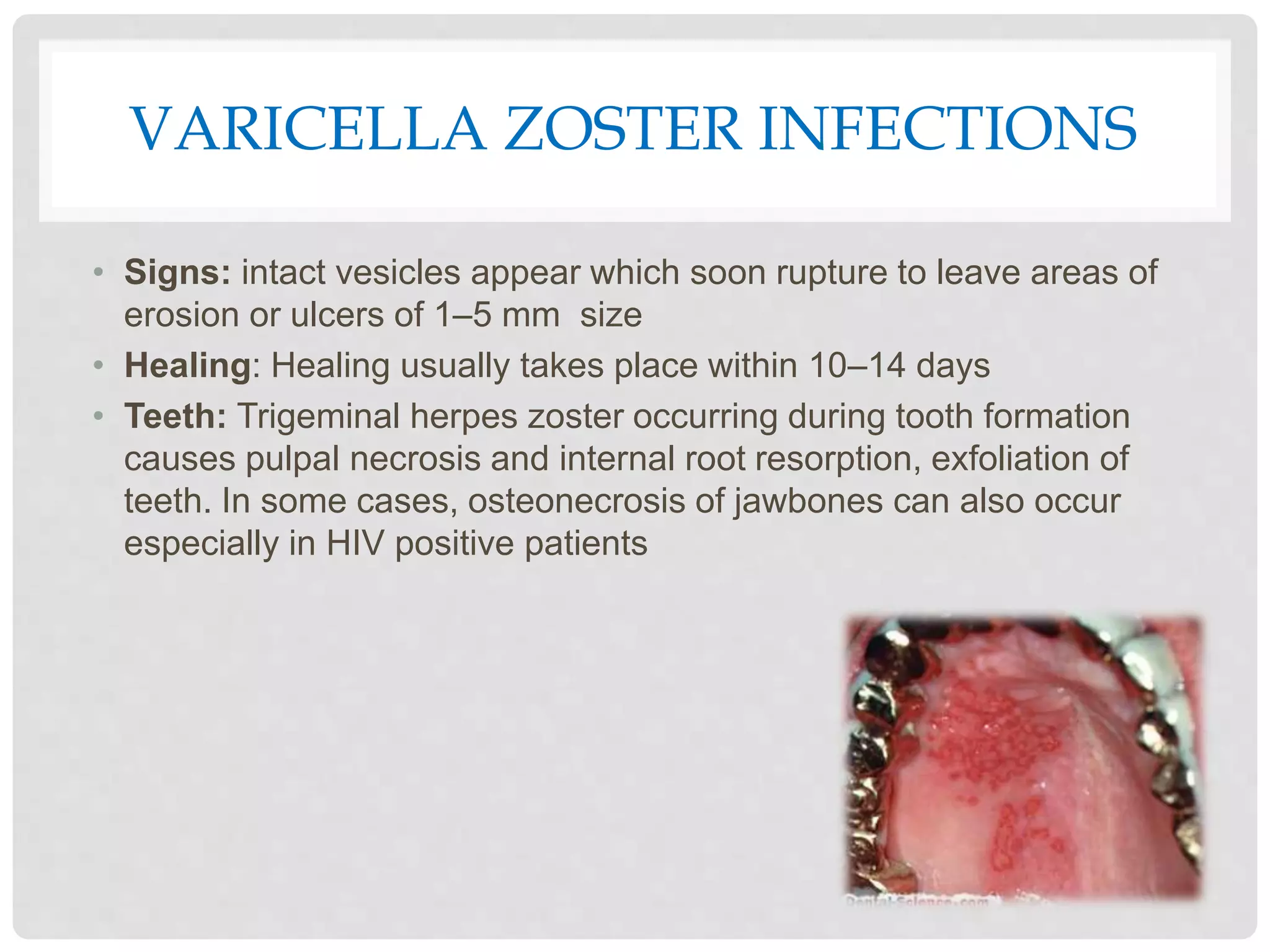 Viral infection ppt | PPTX