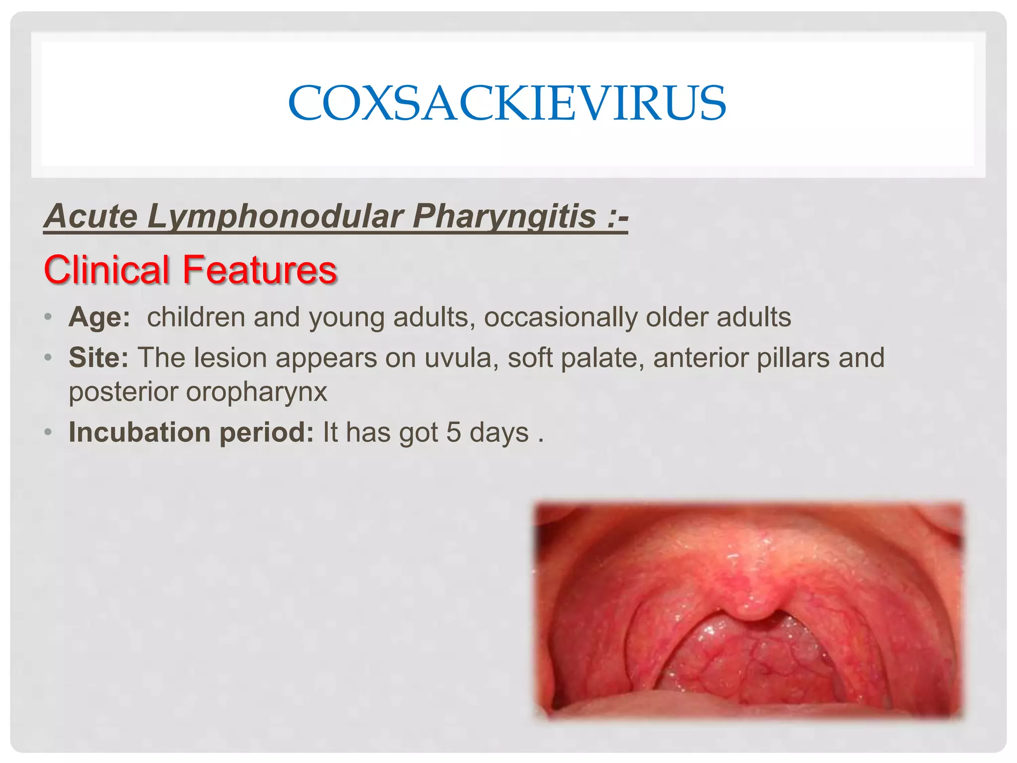 Viral infection ppt | PPTX
