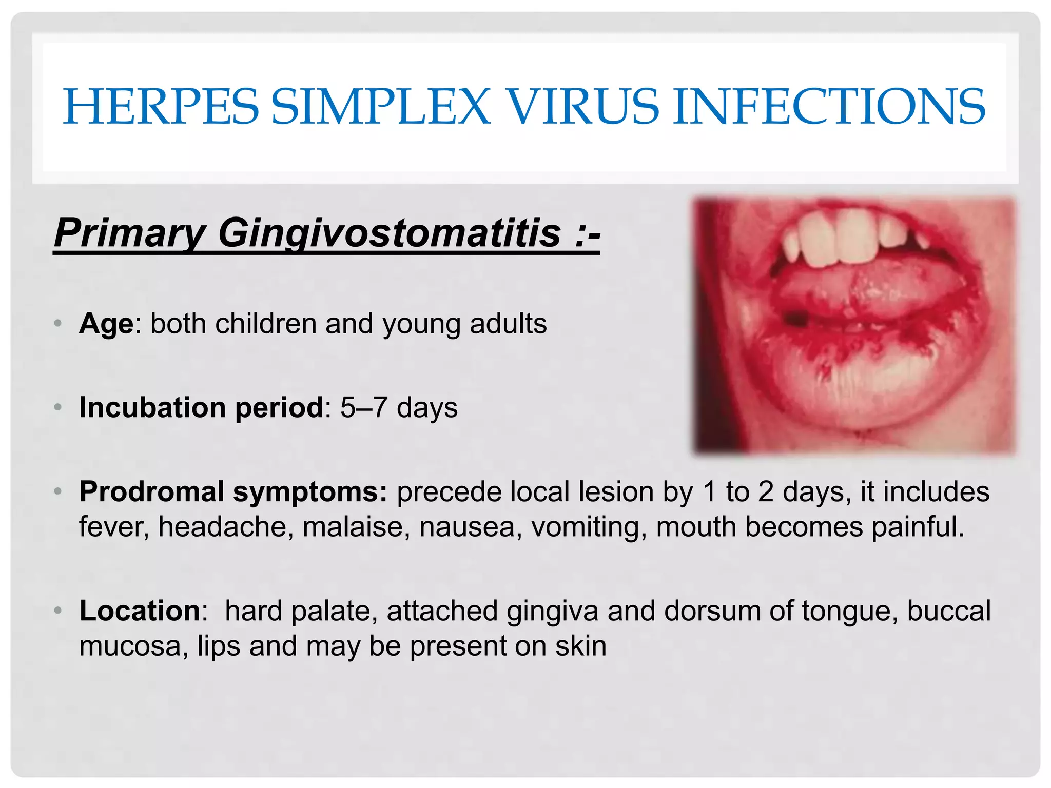 Viral infection ppt | PPTX