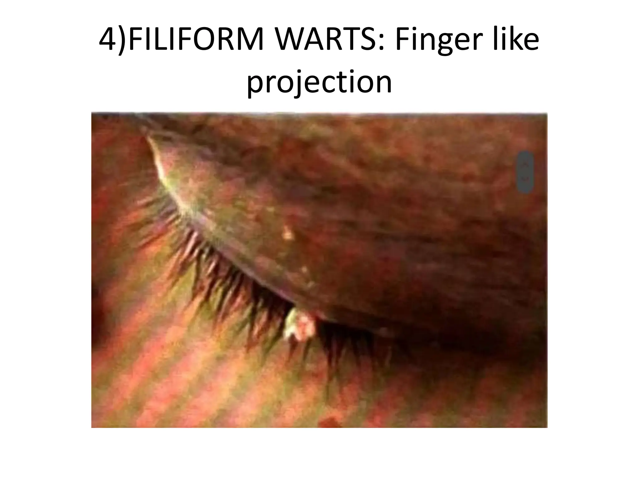 Viral Infection PPT . | PPTX