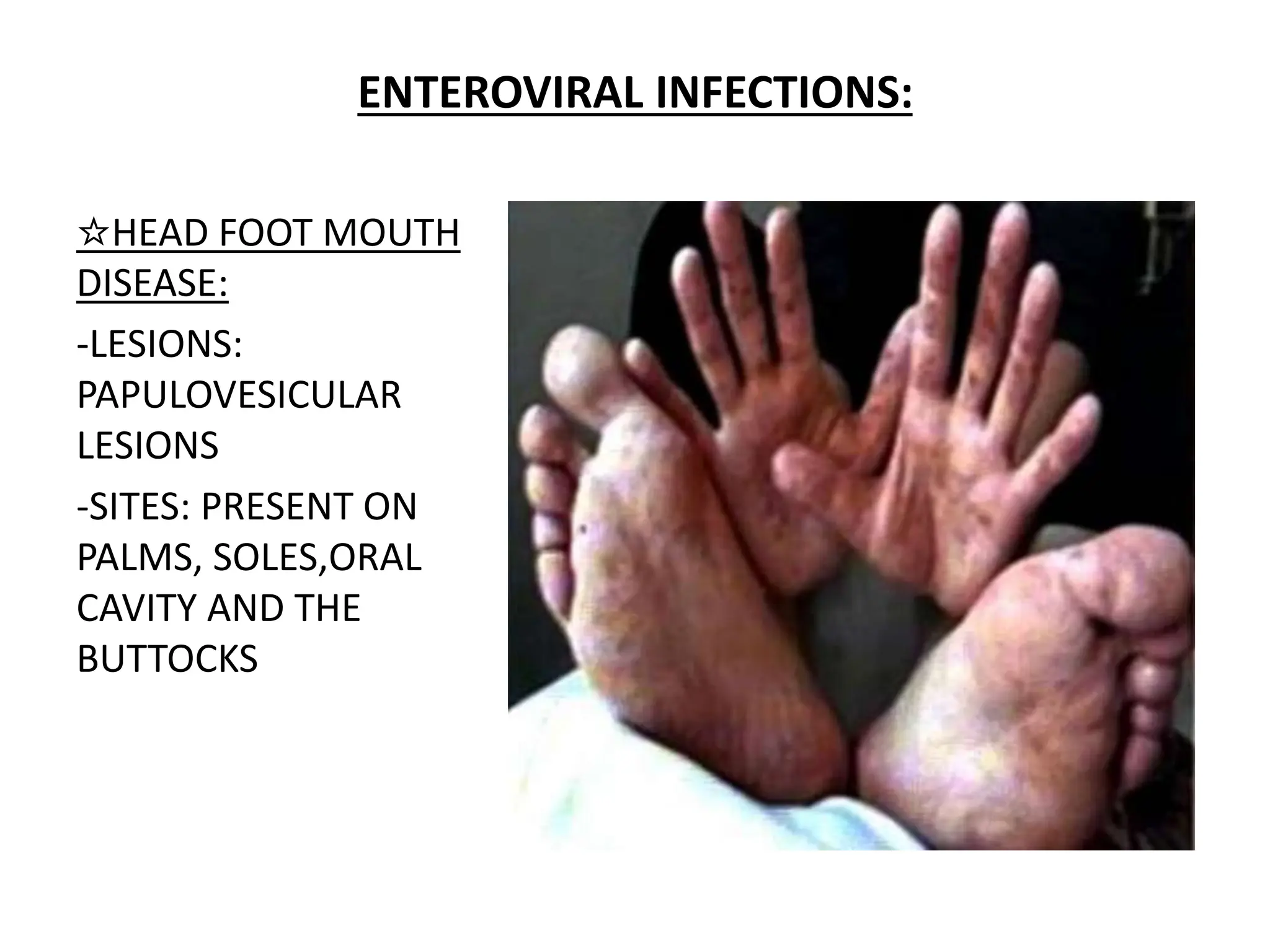 Viral Infection PPT . | PPTX