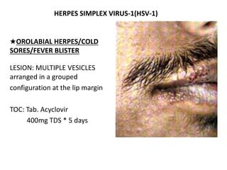 Viral Infection PPT . | PPTX