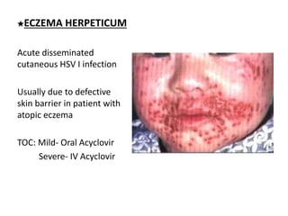 Viral Infection PPT . | PPTX
