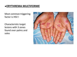 Viral Infection PPT . | PPTX