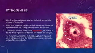 Viral infections.pptx