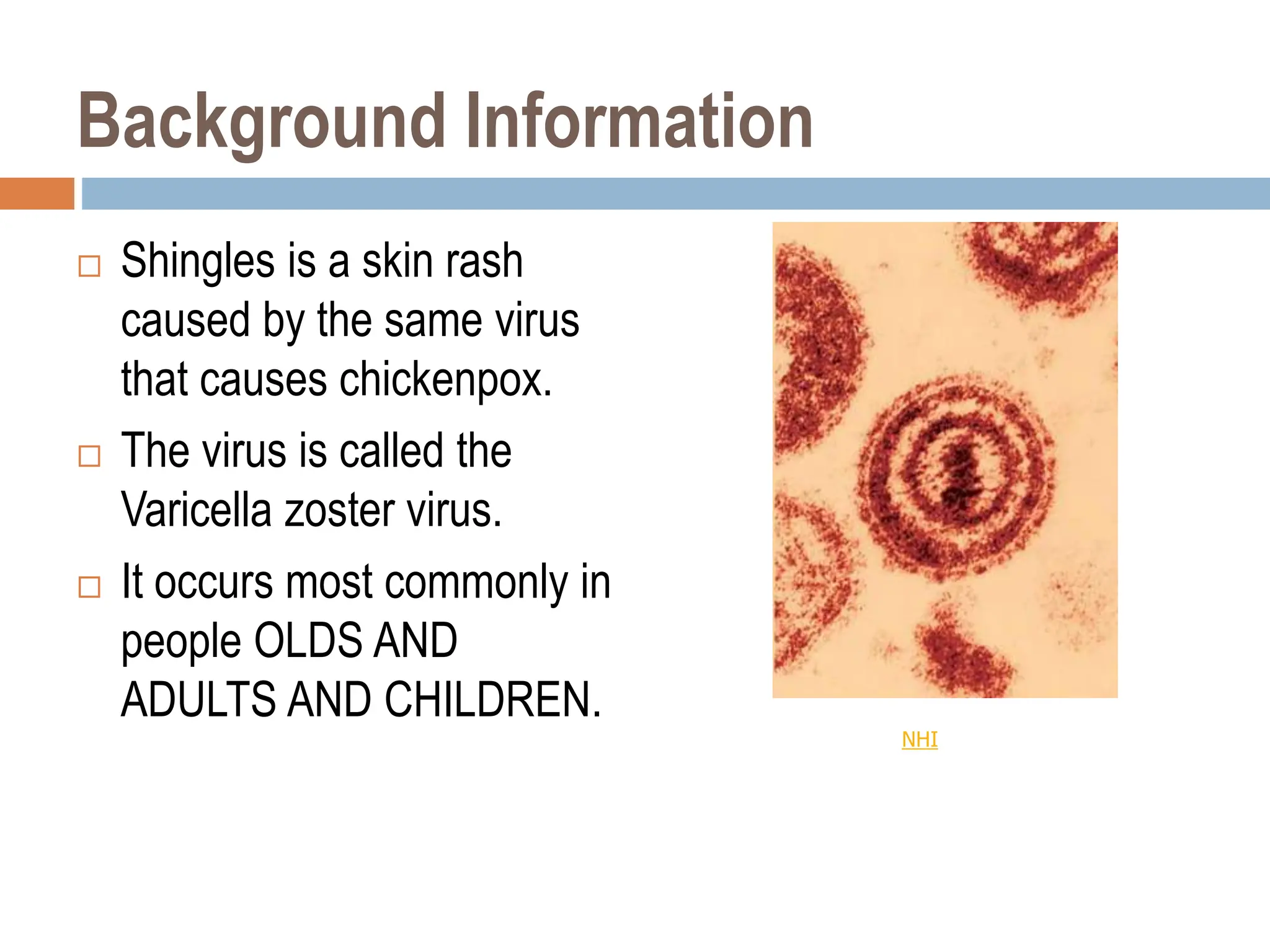viral infections......................ppt