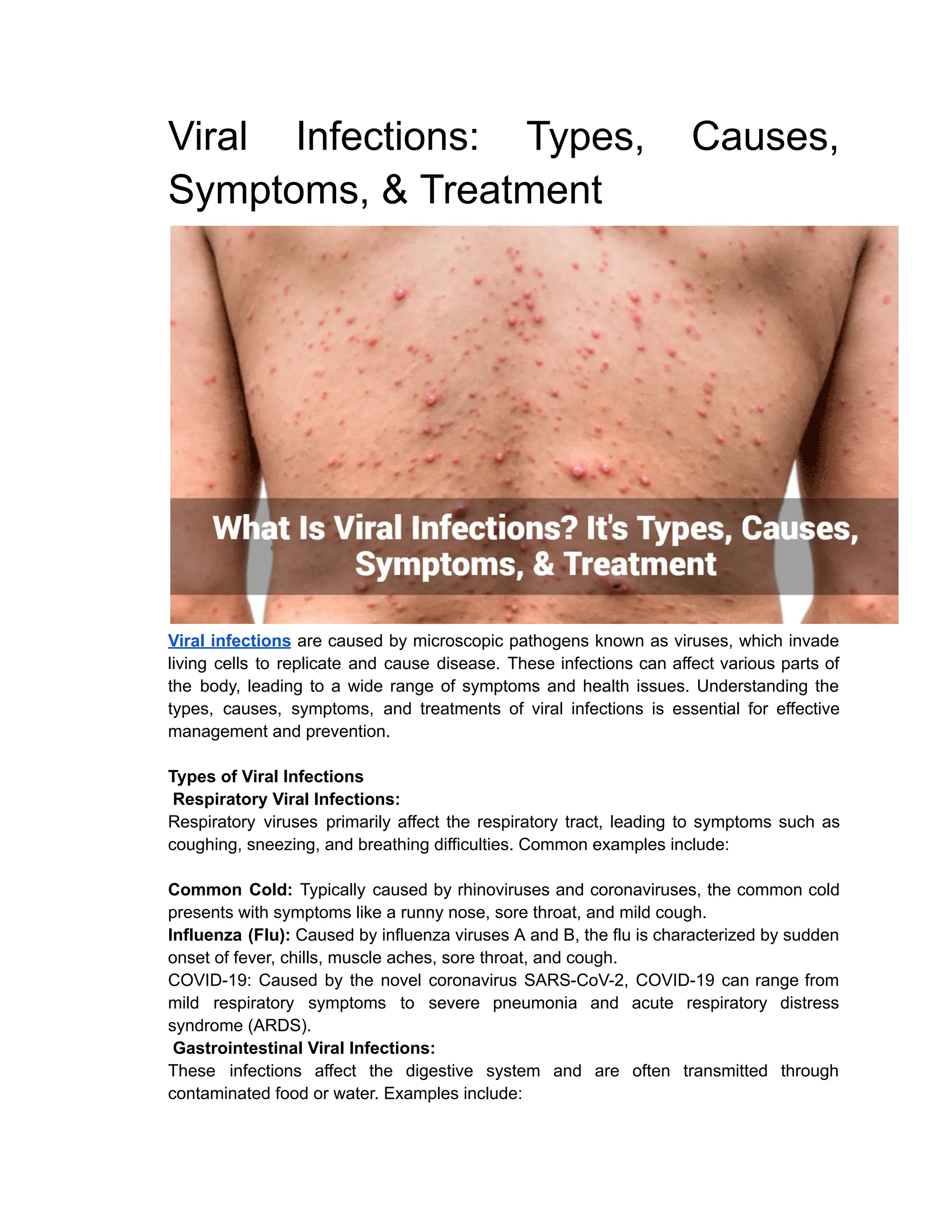 Viral Infections: Types, Causes, Symptoms, & Treatment | PDF