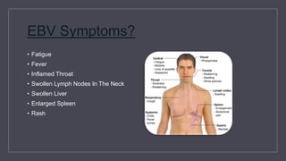 Viral infections in the oral cavity | PPTX